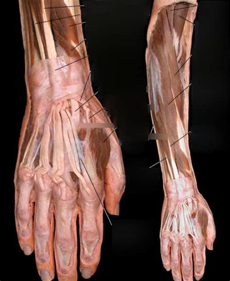 DORSAL FOREARM MUSCLES DEEP LAYER 2 Diagram Quizlet