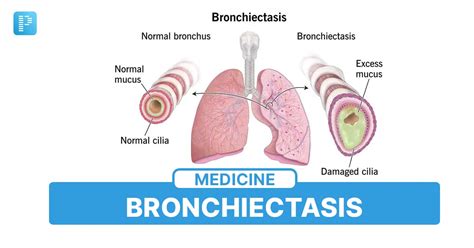 Bronchiectasis Causes Pathophysiology