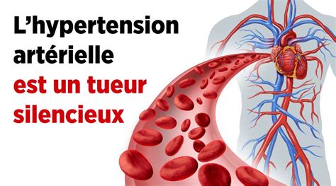 L Hypertension artérielle Nos Conseils de Vie