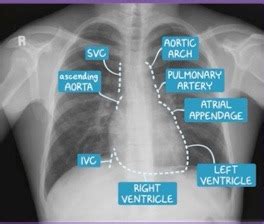 X Ray Interpretation Flashcards Quizlet