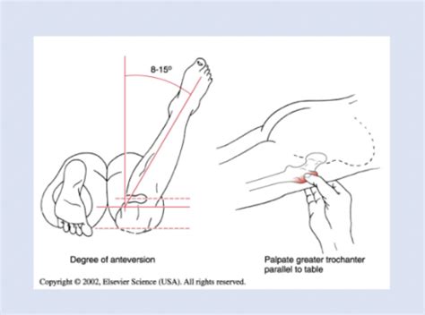 Hip Anatomy Biomechanics Flashcards Quizlet