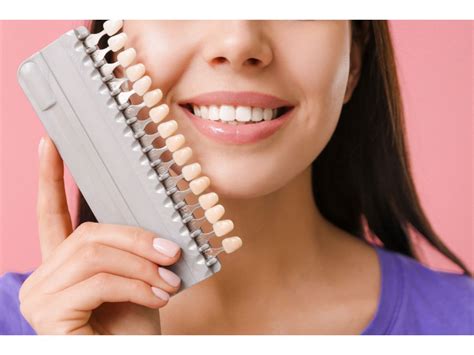 tout savoir sur la durée de vie des facettes dentaires