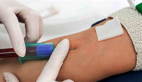 Teste de Tolerância à Glicose Curva Glicêmica MedSimples