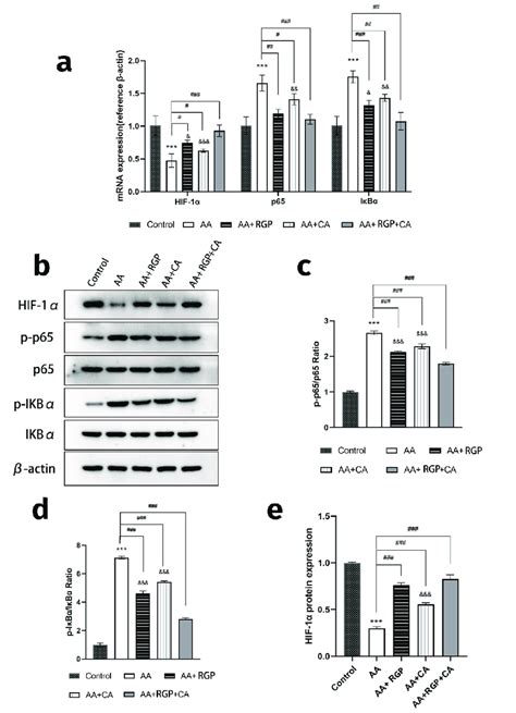 Effects of RGP on HIF 1α NF κB signaling pathway a The mRNA levels of