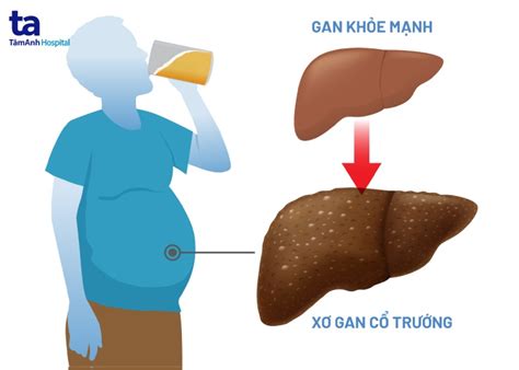 Chia sẻ 84 về hình ảnh gan mới nhất coedo vn