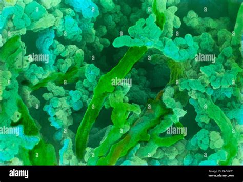 Placenta Coloured Scanning Electron Micrograph SEM Of Chorionic