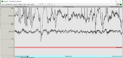 sleep edf database expanded 读取 sleepedfx数据集预处理 csdn博客