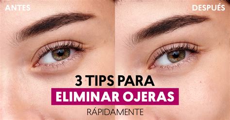 Cómo quitar las ojeras 3 tips para eliminarlas rápidamente Cyzone