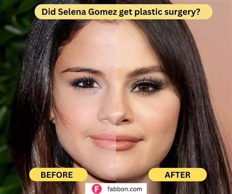 Did Selena Gomez Get Plastic Surgery Fabbon