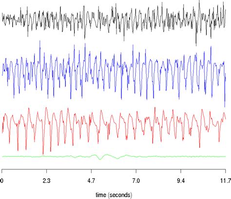 figure 1 from new methods of time series analysis of non stationary eeg data eigenstructure