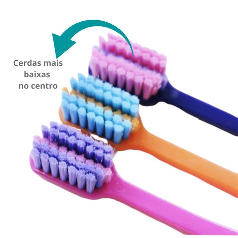 Escova Dental Ortodôntica para Aparelho Fixo