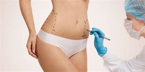 Chirurgie Esth Tique Tunisie Venus Estetika