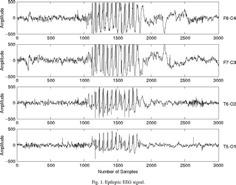 figure 1 from wavelet neural network classification of eeg signals by using ar model with mle