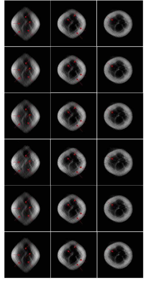 figure 1 from reweighted anisotropic total variation minimization for limited angle ct