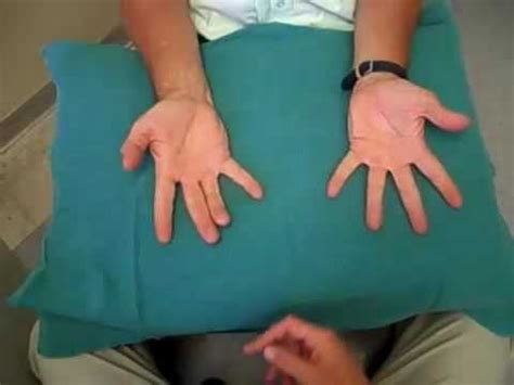 Ulnar Nerve Palsy Youtube