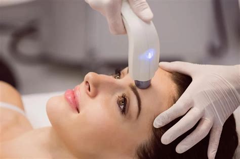 Cómo es el procedimiento de láser CO2 fraccionado Dermatología Perú
