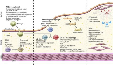 JCI Through The Layers How Macrophages Drive Atherosclerosis Across