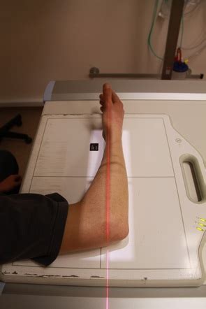Forearm Lateral View Radiology Reference Article Radiopaedia Org