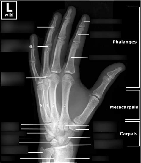 Diagram Of 2 PA Oblique Hand Anatomy Quizlet