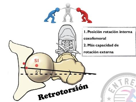 1 Osteologia Y Cinematica De La Cadera Cancellous Bone Bending Moment