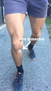 Pes Anserine Bursitis And Tendinopathy Bend Mend Physiotherapy And