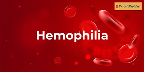 Hemophilia Causes Symptoms Diagnosis Dr Lal Pathlabs Blogs