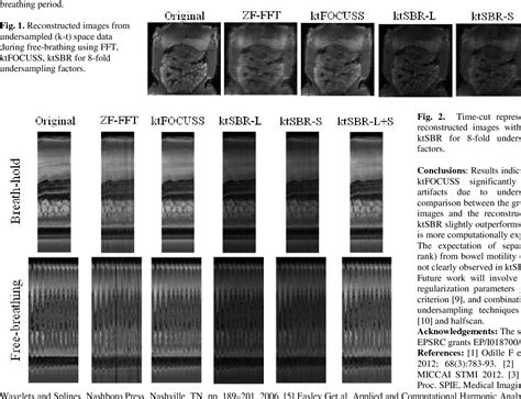 figure 1 from discrete shearlets as a sparsifying transform in a split bregman reconstruction of