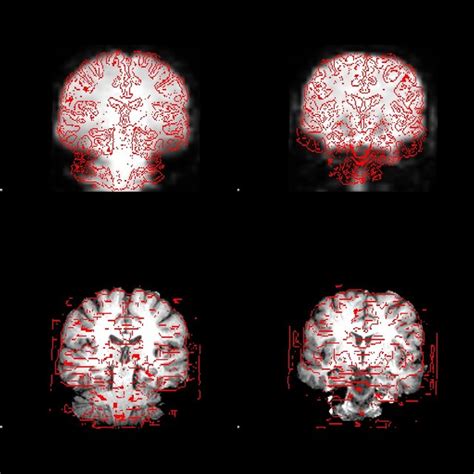 pdf fmri data analysis using fmrib