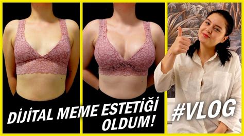 Meme Büyütme Ameliyatı Oldum Vlog memeestetiği YouTube