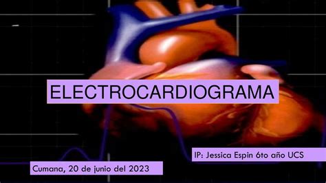 Electrocardiograma Olimar Bello UDocz
