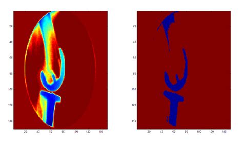an example of the adaptive thresholding technique normalized cut vertex download scientific