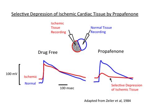 Cardiac Action Potential Drugs