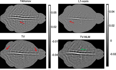 non‐local means improves total‐variation constrained photoacoustic image reconstruction