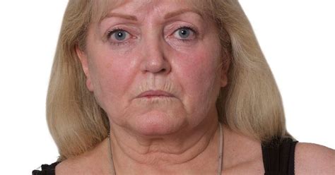The 57 Year Old Admits She Feels Like A New Woman After Going Under The Knife To Have A £6 000
