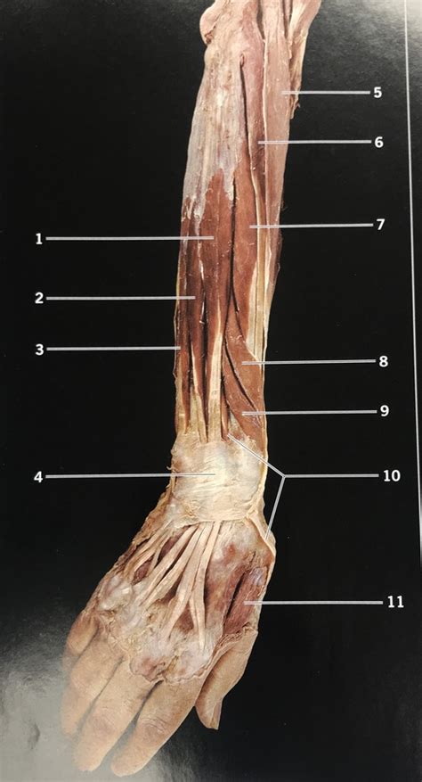 Superficial Muscles Of The Forearm Posterior View Diagram Quizlet