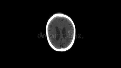 Brain Scan Visualization Animation Diagnosis Data On Laboratory