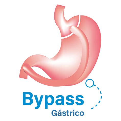 Bypass Gástrico GMEDIQ cirugía bariátrica Quito y Ambato 1