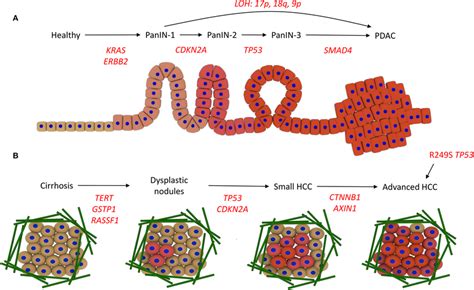 Driver Mutations In PDAC And HCC Development A Development Of PDAC