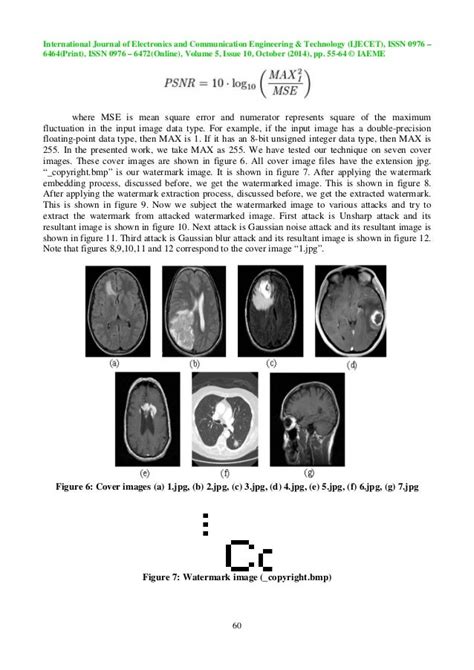 digital watermarking on medical images using dwt