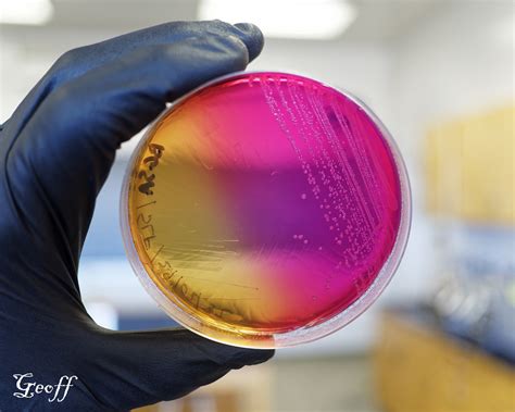 Salmonella Growing On Brilliant Green Sulfa Agar Salmonell Flickr