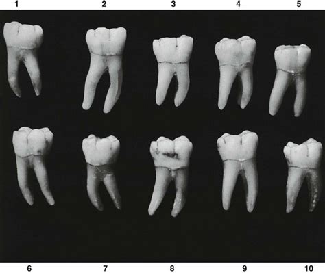 Maxillary And Mandibular Molars