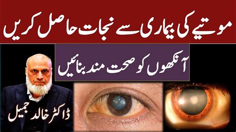 3 Most Common Eye Problems And Their Treatment Lecture 224 YouTube