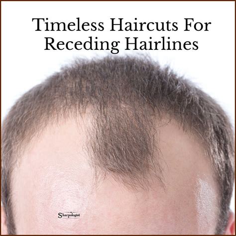 Understanding Fade With Receding Hairline Styles Solutions And