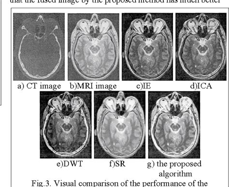 Figure From Medical Image Feature Extraction And Fusion Algorithm