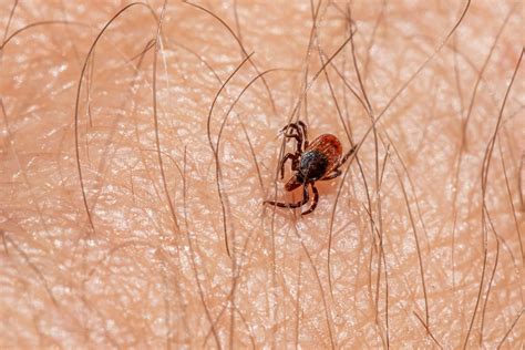 Febre Maculosa Campinas Atesta Morte Por Carrapato Estrela
