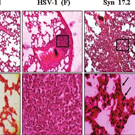 Histopathology Of Lungs From BALB C Mice Intranasally Infected With 1