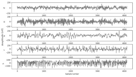 EEG Dataset Of Epileptic Seizure Patients IEEE DataPort 50 OFF