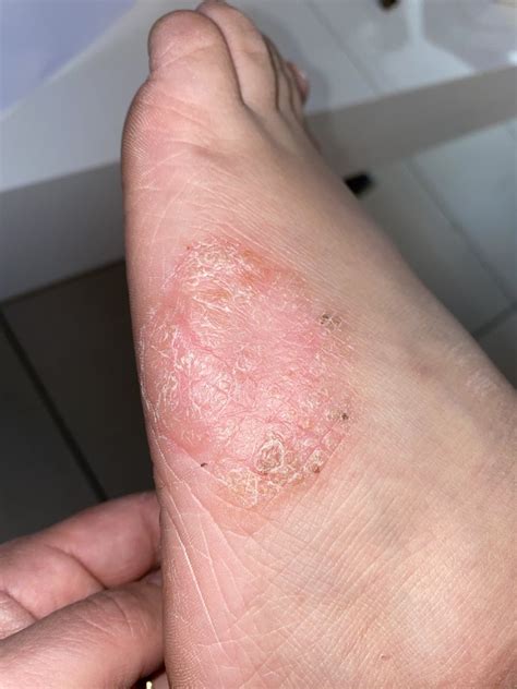 Info Dermatologia Pediatrica DermaClub Forum
