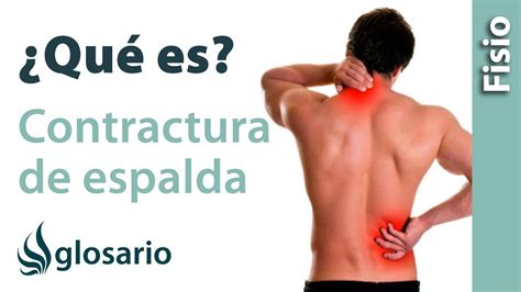 CONTRACTURA DE LA ESPALDA Qué es YouTube