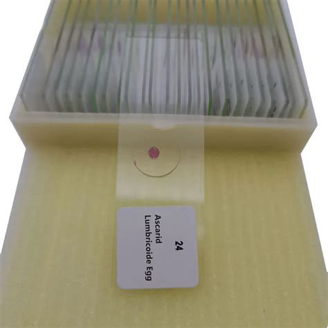 Portaobjetos De Microscopio Preparado Para Parasitolog A M Dica 25